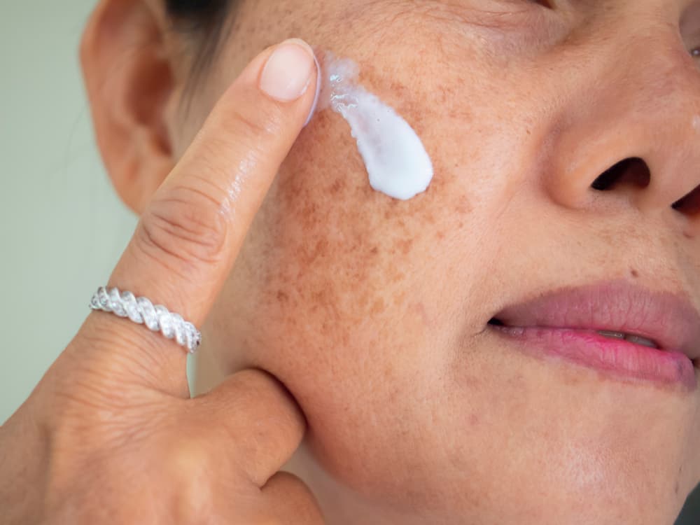 The 10 Best Safe and Effective Age Spot Removers in 2025 - Beauty Mag