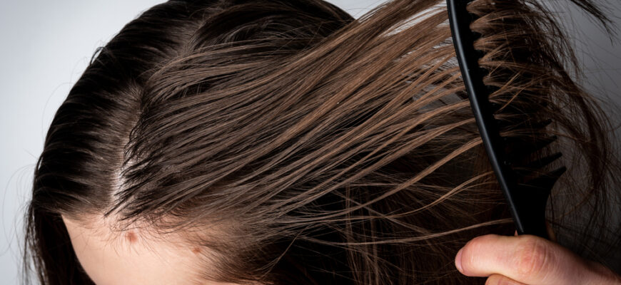 How to Get Coconut Oil Out of Your Hair - 7 Proven Methods